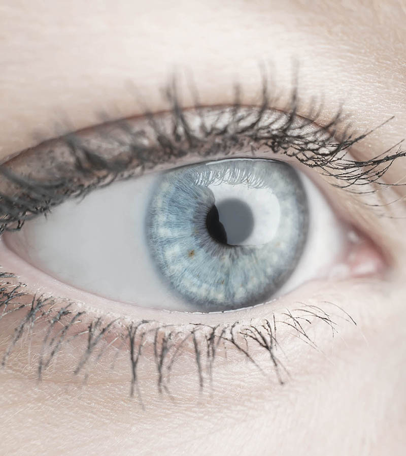 Patologia dell'occhio: Cataratta - Polo Oculistico Emiliano